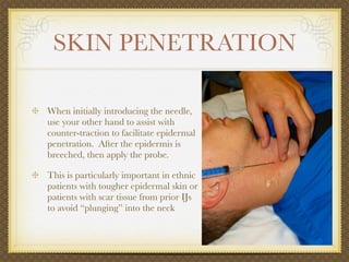 Breakdown of One-Handed IJ | KEY