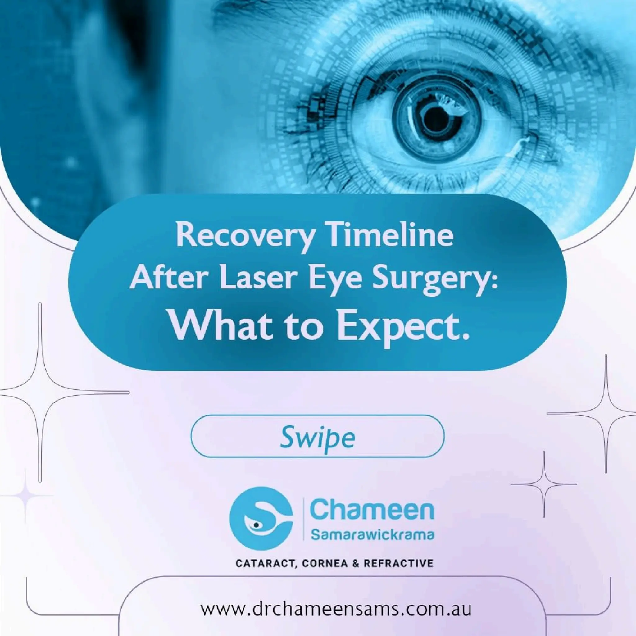 Laser Eye Surgery Recovery: What to Expect | PDF
