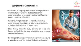 Understanding Diabetic Foot: Symptoms, Risks, and When to Seek Help | PDF