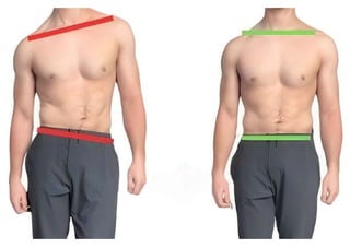 Understanding Lateral Pelvic Tilt: Definitions, Causes, and Solutions | PDF