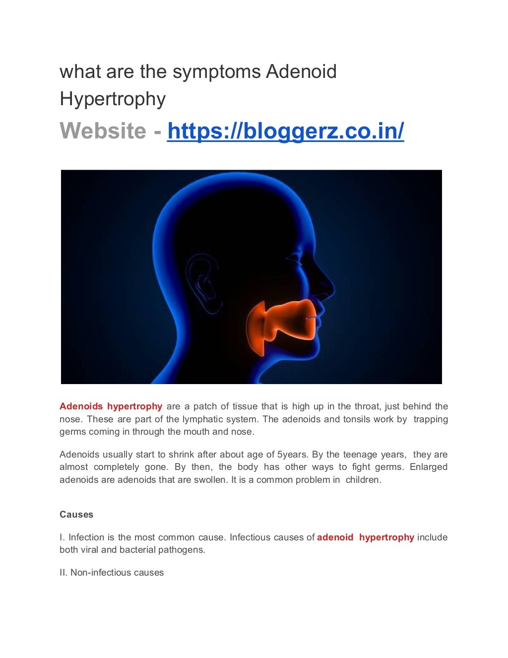 what are the symptoms Adenoid Hypertrophy | PDF