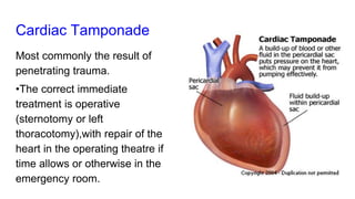 Thoracic Injury and Trauma | PPTX