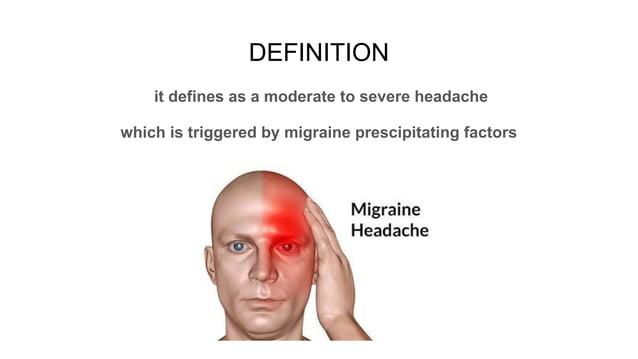 Migraine headache | PPT