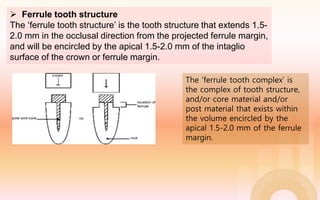 Effect of ferrule and post - journal club Effect of ferrule and post ...