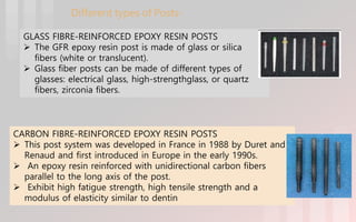Effect of ferrule and post - journal club Effect of ferrule and post ...