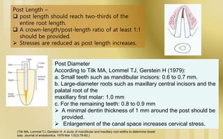 Effect of ferrule and post - journal club Effect of ferrule and post ...
