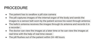 Pill Camera | PPT