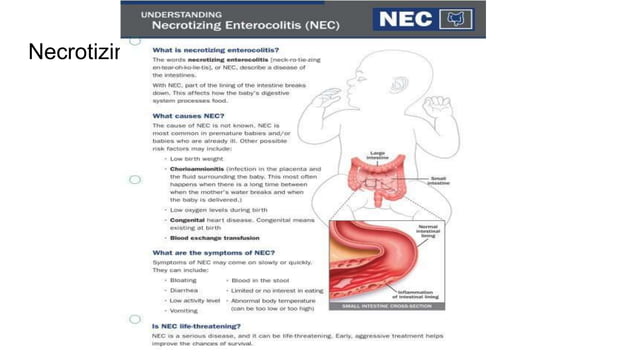 bilious vomiting in newborn.pptx | Digestive Disorders | Diseases and ...