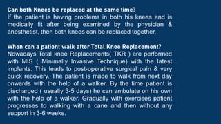 Total Knee Replacement | PPTX