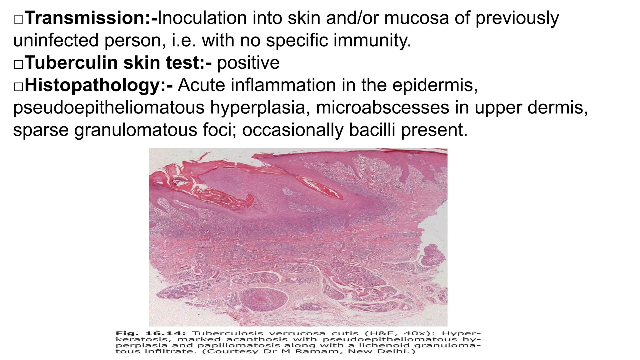Untitled presentation for cutaneous tuberculosis | PDF