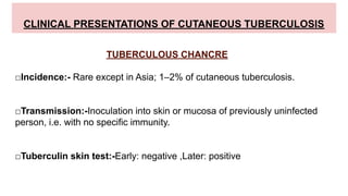 Untitled presentation for cutaneous tuberculosis | PPT
