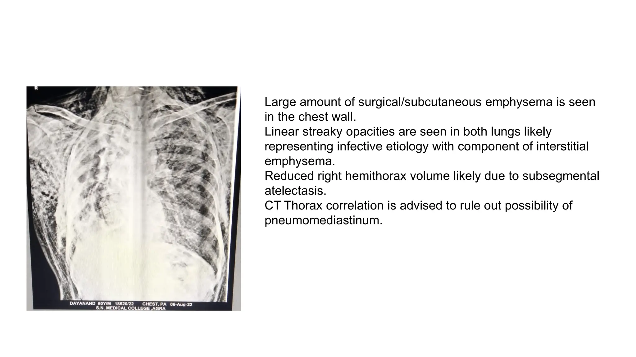 clinico-radiological meet - X rays with clinical | PPTX