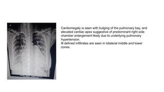 clinico-radiological meet - X rays with clinical | PPTX
