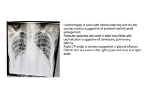 clinico-radiological meet - X rays with clinical | PPTX