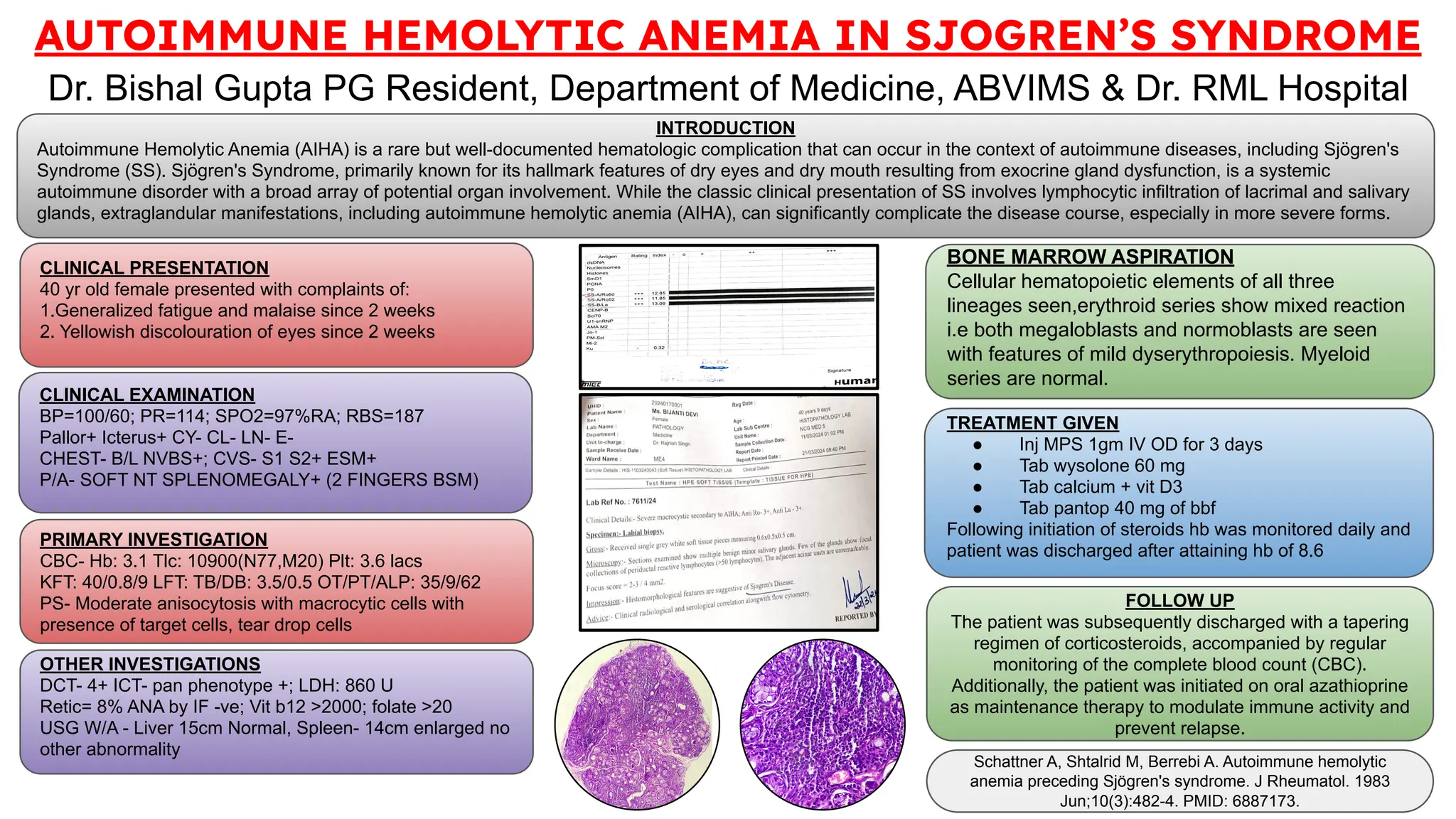 Autoimmune hemolytic anemia in sjogren's.pdf