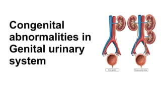 Congenital anomalies of genital urinary system pot | PPTX