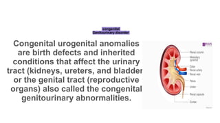 Congenital anomalies of genital urinary system pot | PPTX