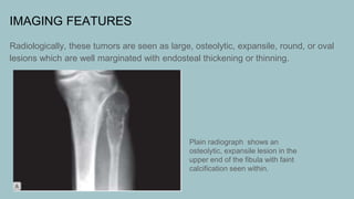 RADIOLOGICAL APPROACH TO malignant bone tumors.pptx