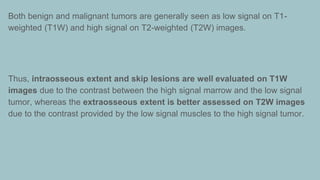 RADIOLOGICAL APPROACH TO malignant bone tumors.pptx