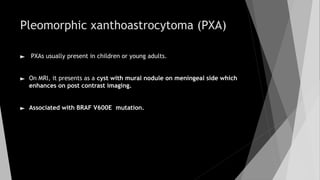 neurology tumors cysts and disesaes partb 1 | PPTX