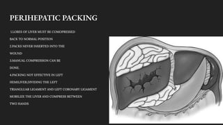 Management of Liver Injuries | PPT