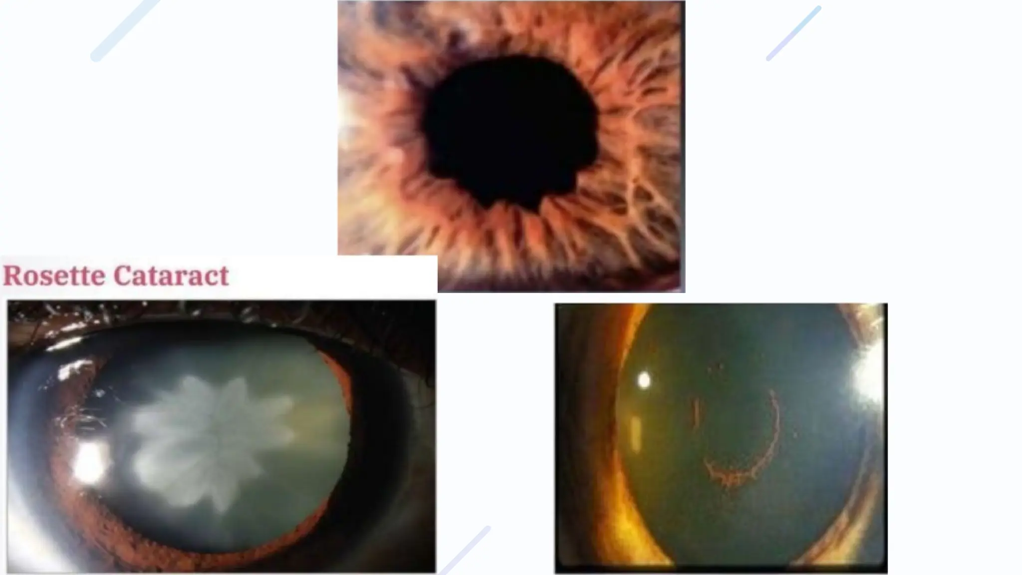 Ocular trauma classification..........pdf