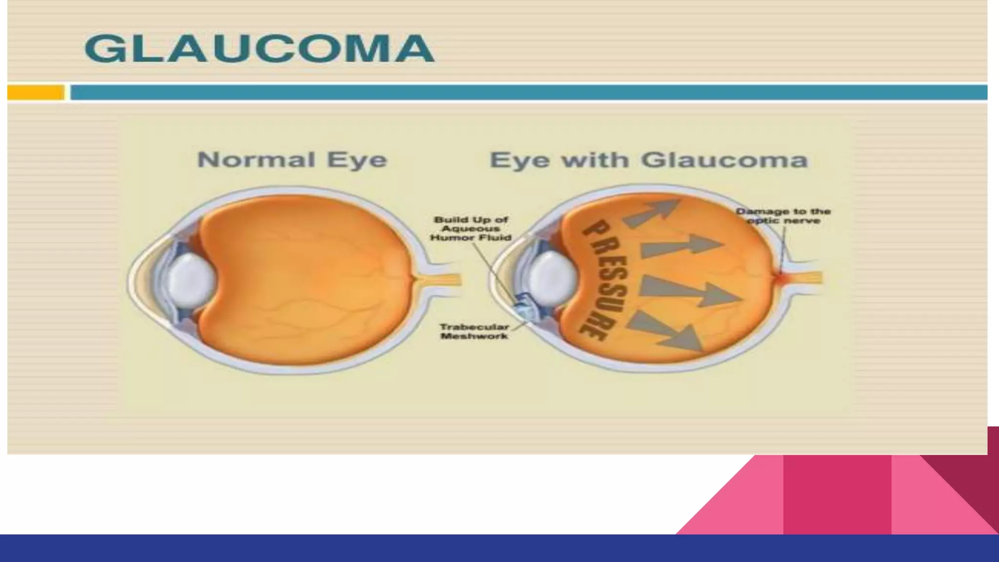 MYDRIATIC AND MIOTIC AGENTS AND DRUGS USED IN GLAUCOMA | PPTX