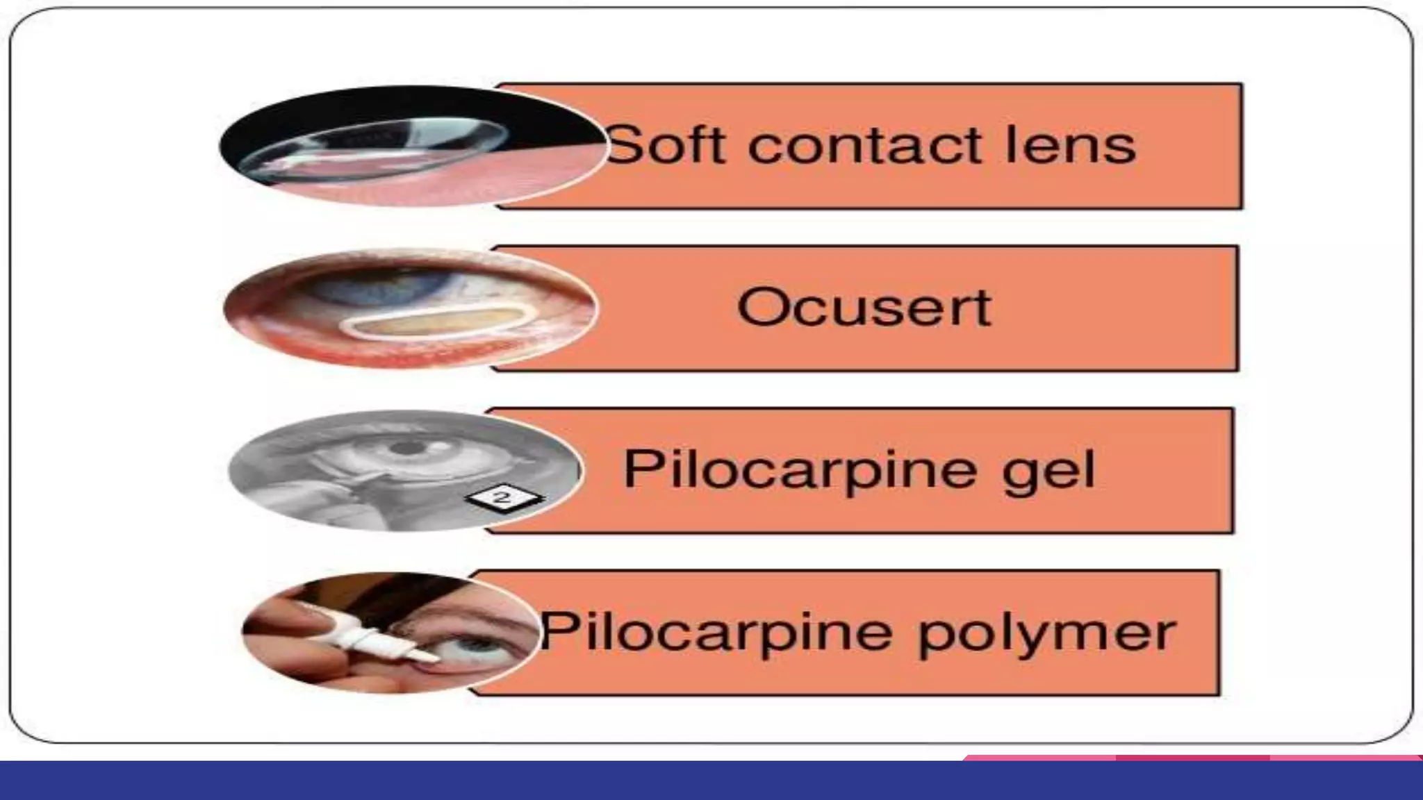 MYDRIATIC AND MIOTIC AGENTS AND DRUGS USED IN GLAUCOMA | PPTX | Illegal ...