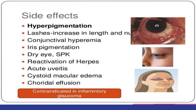 MYDRIATIC AND MIOTIC AGENTS AND DRUGS USED IN GLAUCOMA | PPTX | Illegal ...