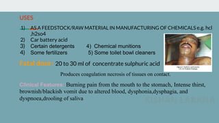 Mushroom poisoning and caustics-inorganic acids and alkali | PDF