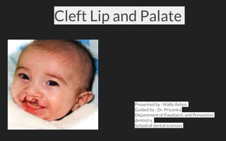 cleft lip and palate by malik ashim | PPTX