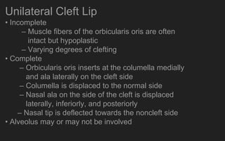 cleft lip and palate by malik ashim | PPTX