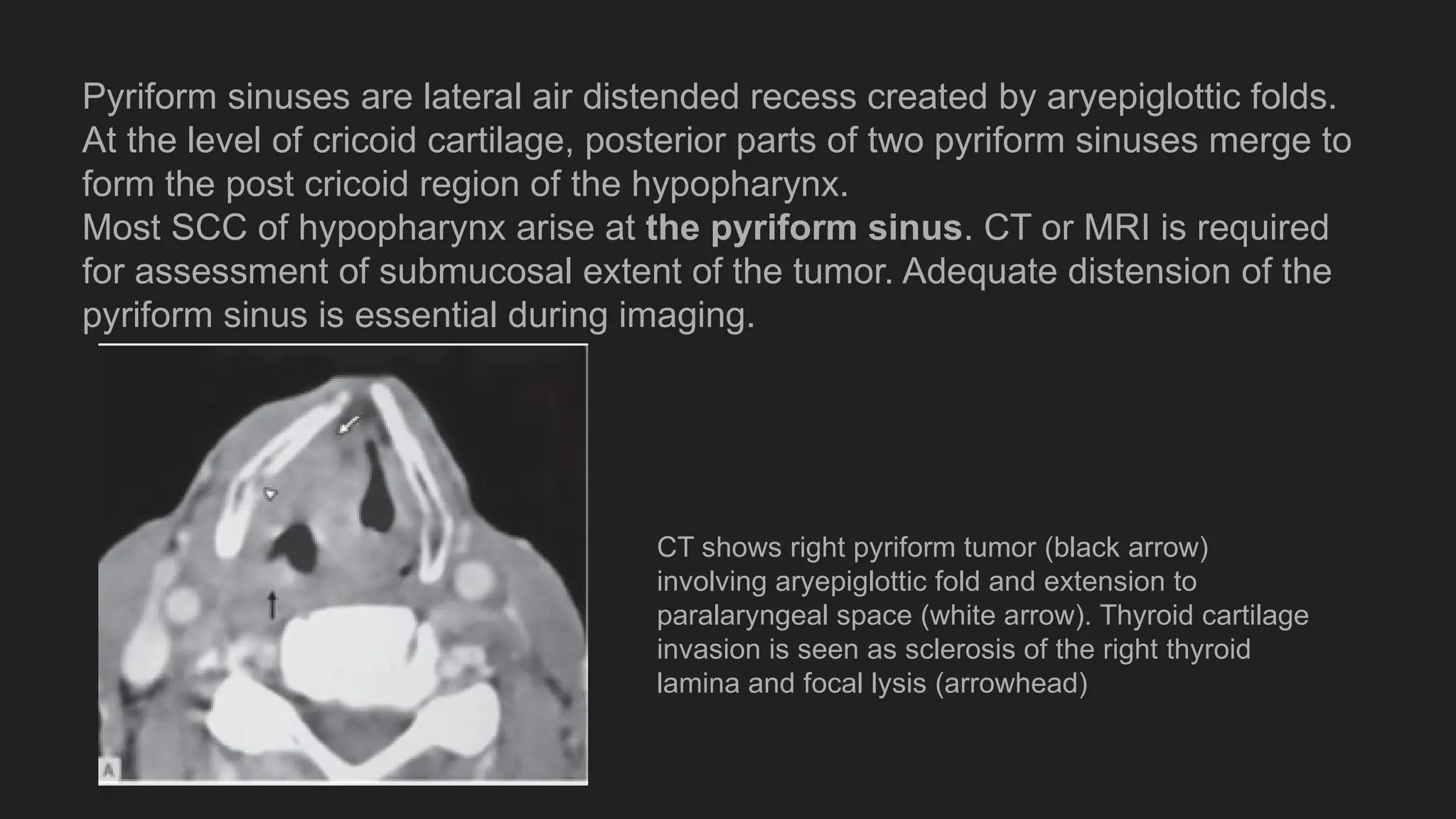 larynx and hypopharynx radiology anatomy | PPTX