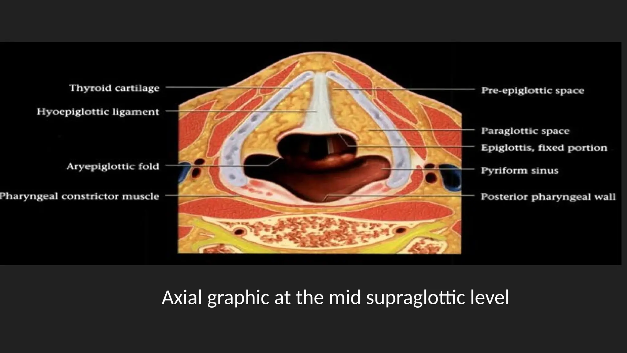 larynx and hypopharynx radiology anatomy | PPTX