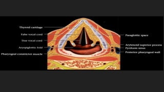 larynx and hypopharynx radiology anatomy | PPTX