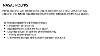 paranasal sinuses radiology pathology anatomuy | PPTX