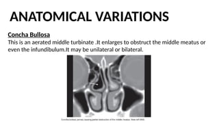paranasal sinuses radiology pathology anatomuy | PPTX