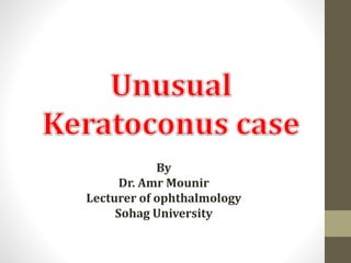 Unusual keratoconus-case | PPTX