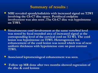 Unusual Cord And Disc Tb | PPT