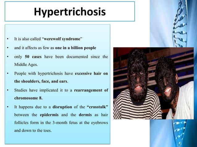 Unusual genetic mutations in human | PPT