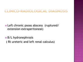 Unusual presentation of psoas abscess _a case | PPTX
