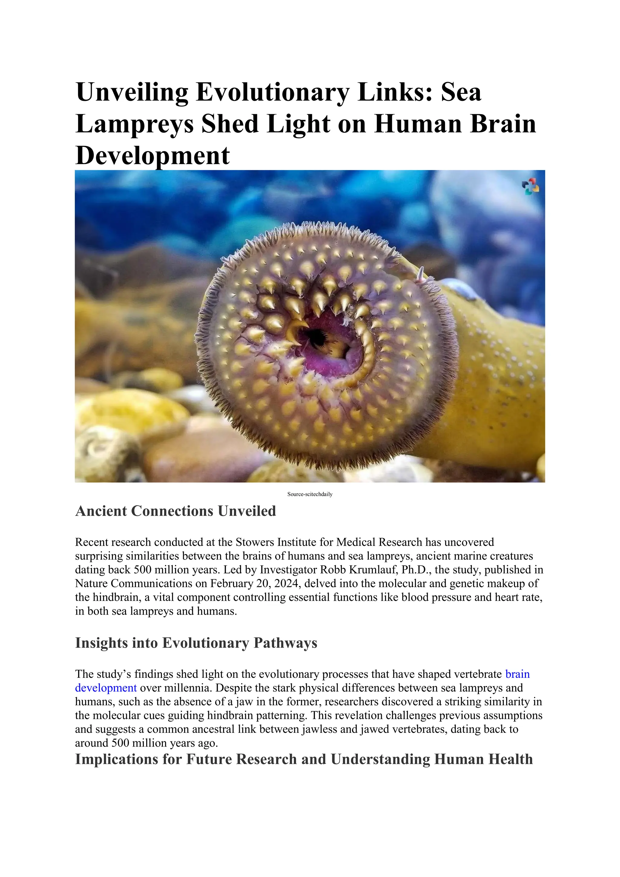 Sea Lampreys Shed Light on Human Brain Development | The Lifesciences ...
