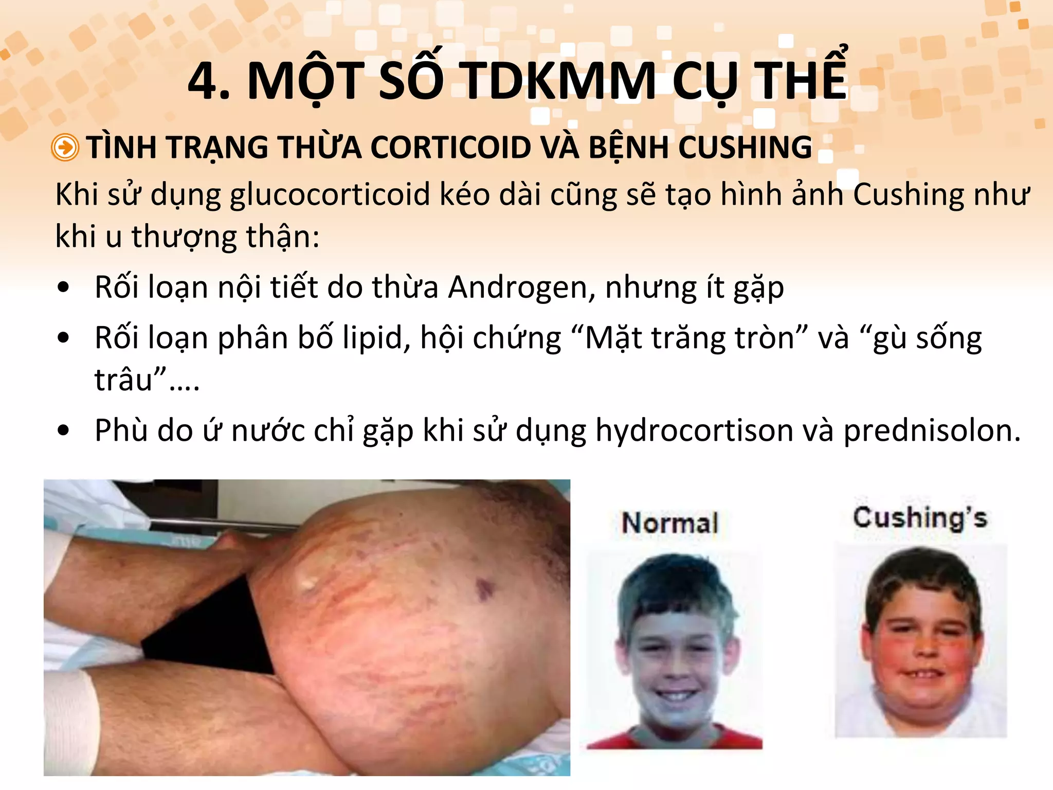 Adverse effects of Corticosteroids - Tác dụng KMM của các Glucocorticoid | PPTX