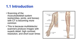 UNZA Part 9- CT of Musculoskeletal System-1.pdf