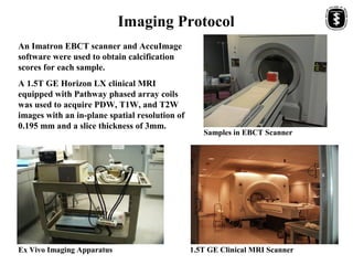 130 mri assessment of human atherosclerotic disease | PPT