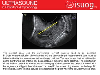 How to measure cervical length | PPT