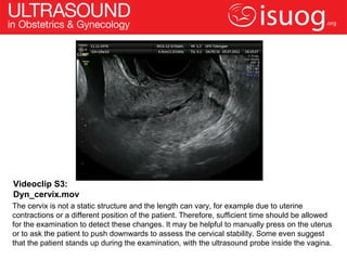 How to measure cervical length | PPT
