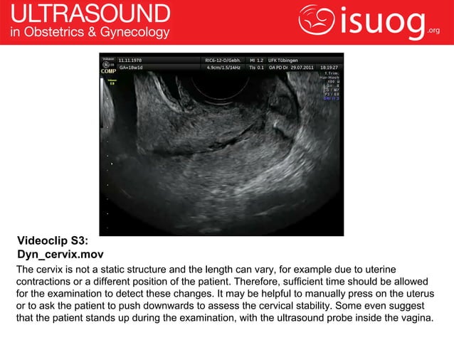 How to measure cervical length | PPT | Pregnancy | Reproductive Health