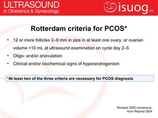 UOG Journal Club: Polycystic ovaries at ultrasound: normal variant or ...