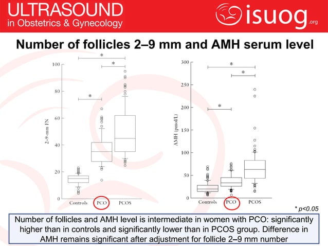 UOG Journal Club: Polycystic ovaries at ultrasound: normal variant or ...